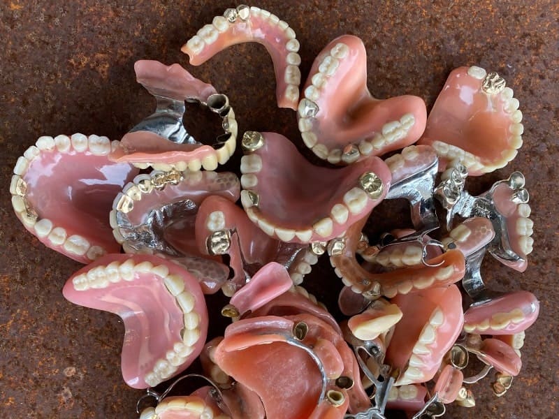 Zahngold Preise: das sollten Sie über Ihr Zahngold wissen