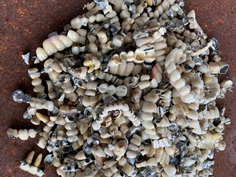 Zahngold Preise: das sollten Sie über Ihr Zahngold wissen